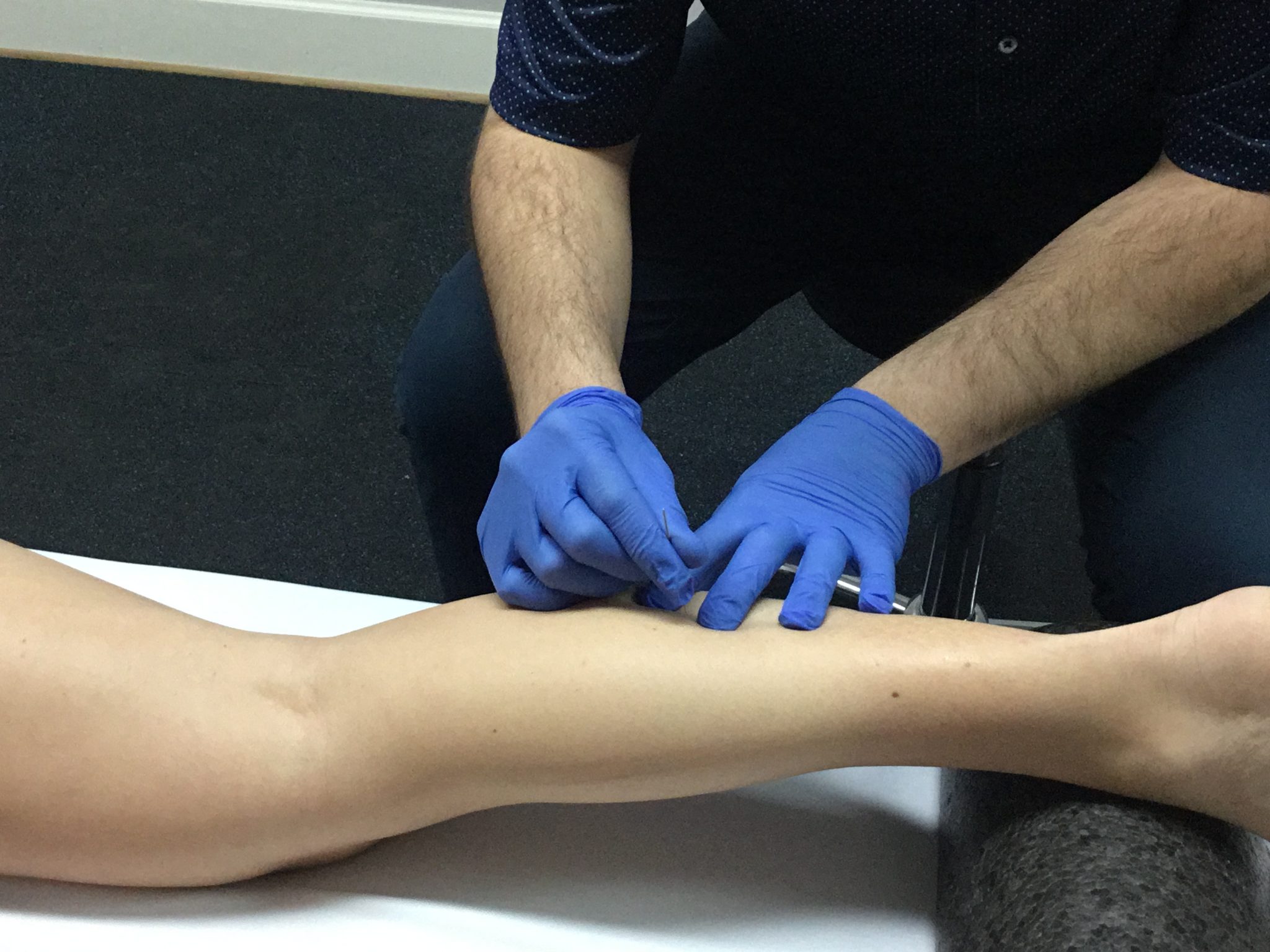 Getting to the Point - Dry Needling - IPA Physio