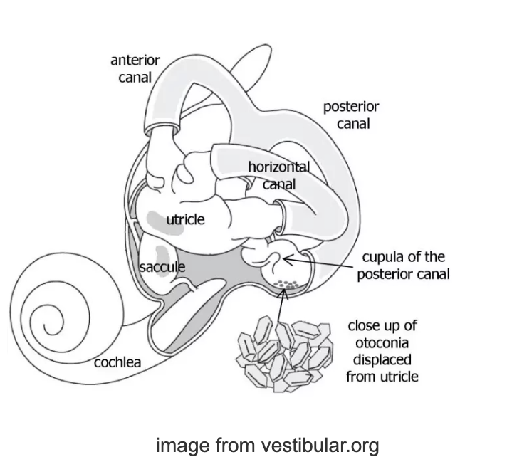 Could you have BPPV AKA Top Shelf or Positional Vertigo? - IPA Physio
