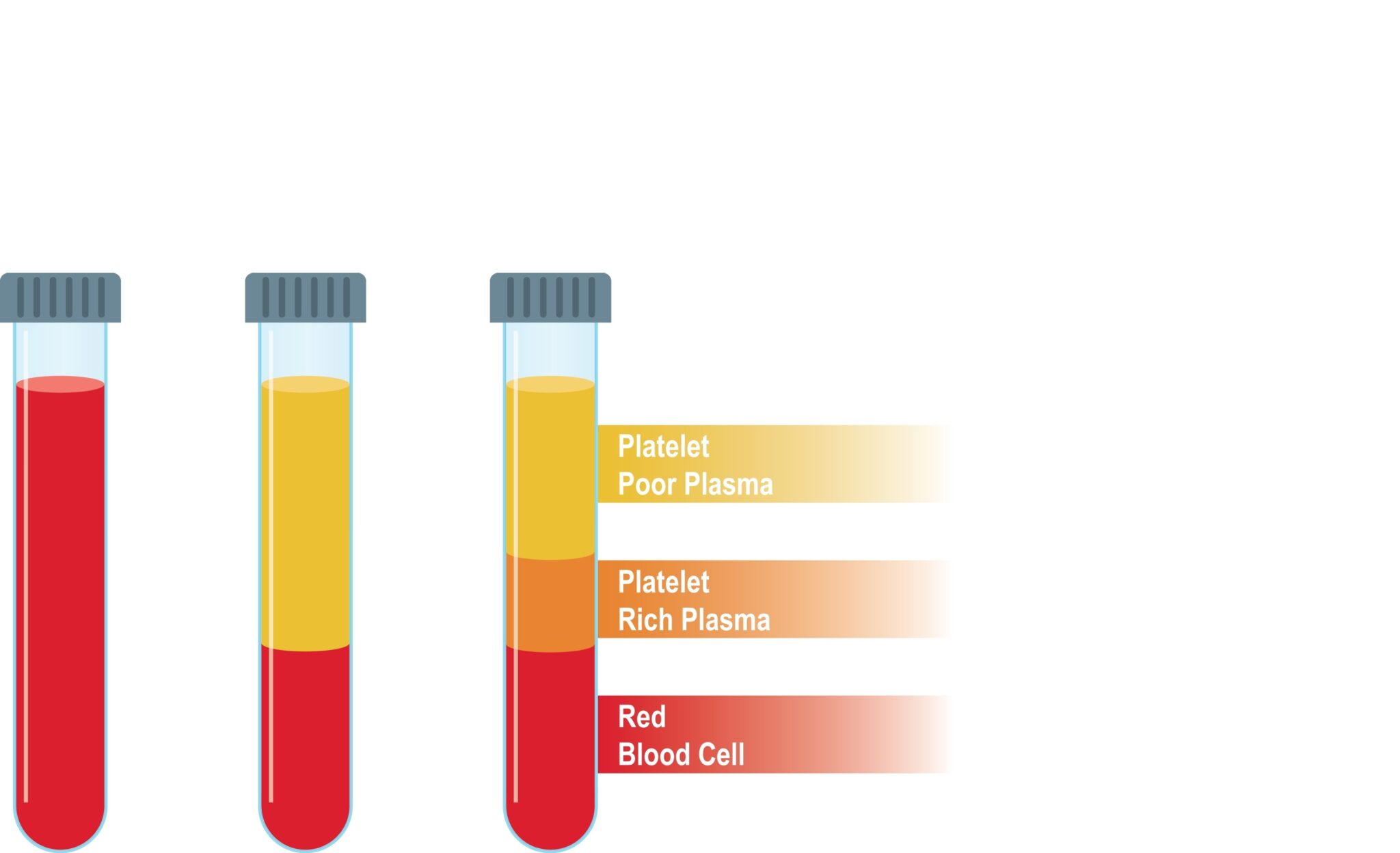 Return to Play Guidelines - Muscle Strains - IPA Physio